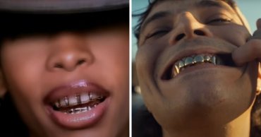 Grillz Fashion History Unveiled: A Teeth Craze 101